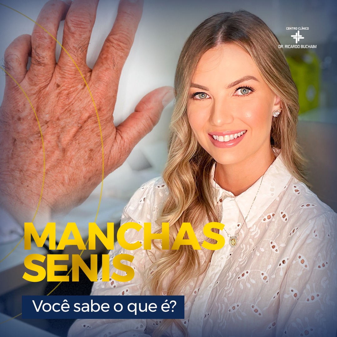 Manchas senis: você sabe o que é? – Centro Clínico Dr. Ricardo Buchaim